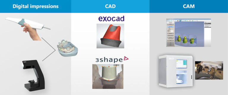 Digital Dentistry Workflow In Dental Lab - BLZ Dental | Dental Scanner