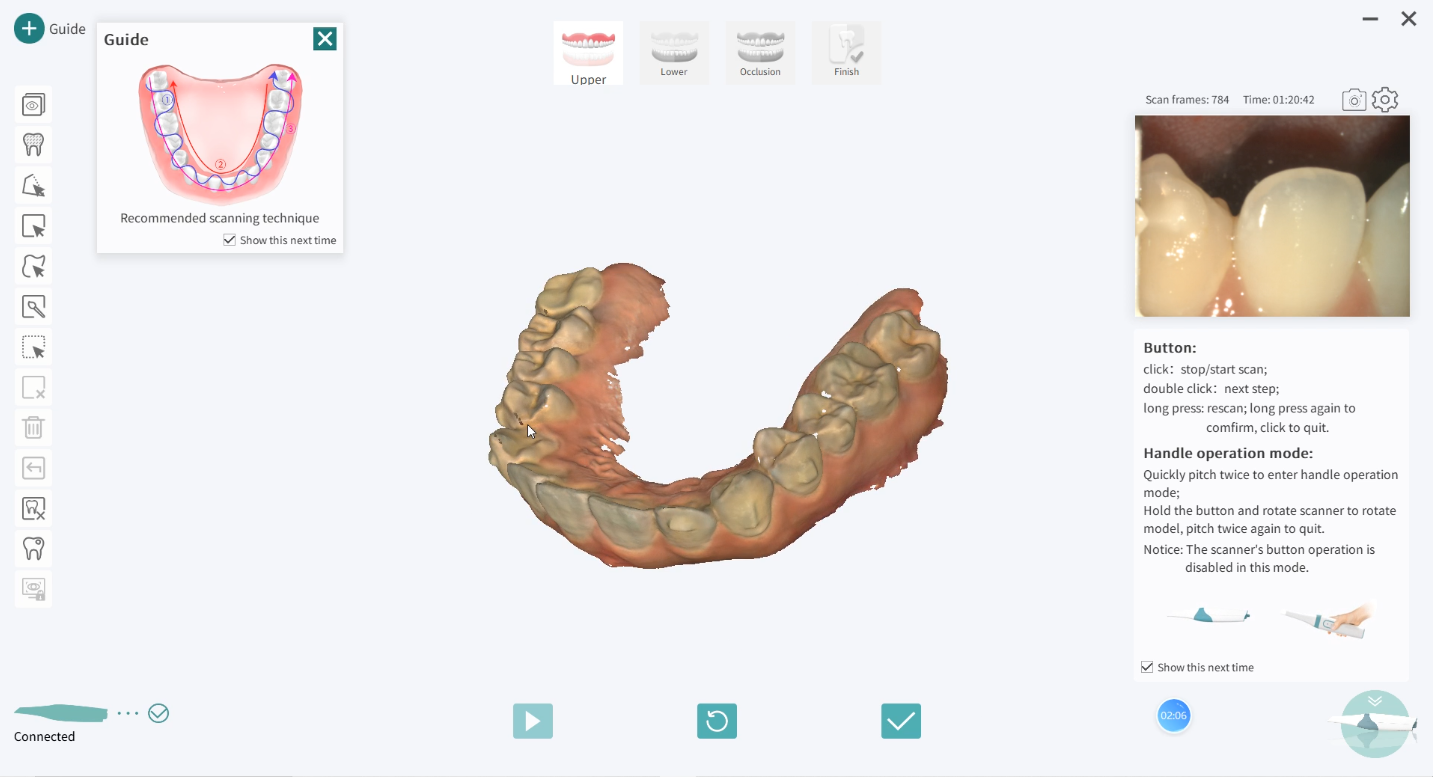 What Intraoral Scanning Techniques Are Currently Used What Intraoral Scanning Techniques Are Currently Used