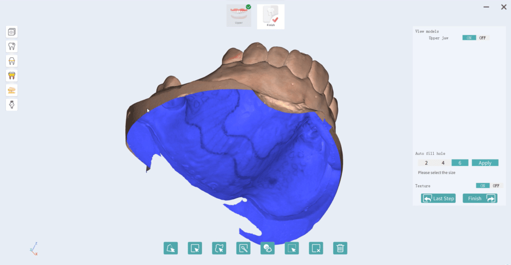 Feature | Block Out - BLZ Dental | Dental Scanner