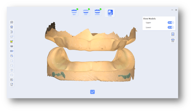 How to Scan Dental Edentulous Case with Intraoral Scanner