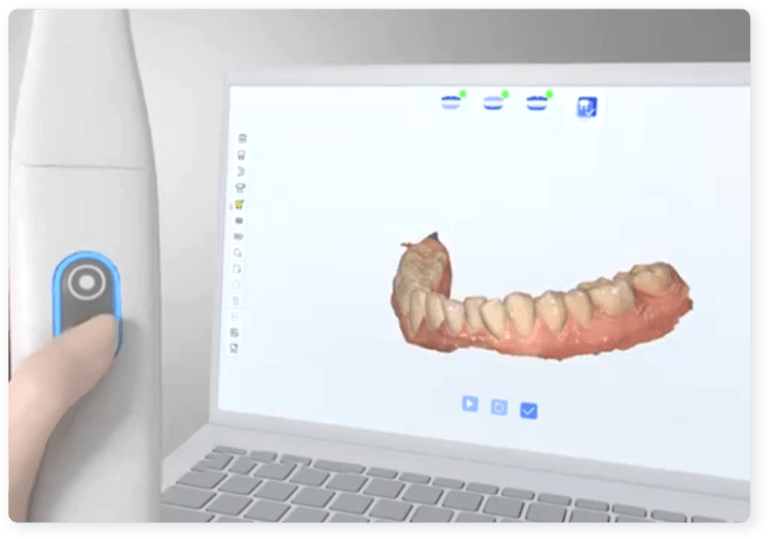 BLZ Intraoral scanner INO200 - BLZ Dental | Dental Scanner